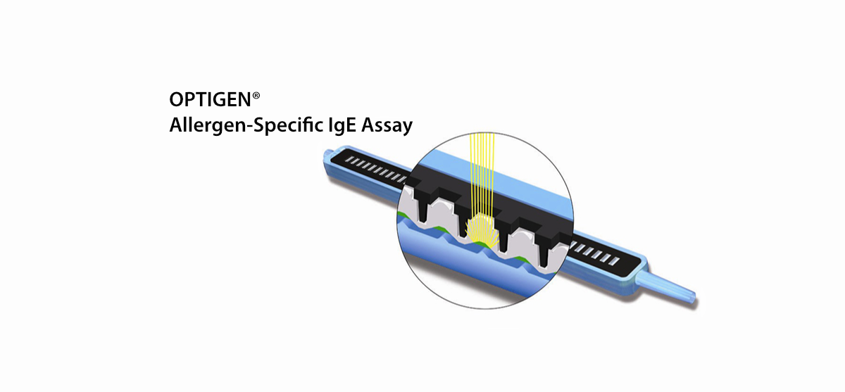 OPTIGEN® Allergen-Specific IgE Assay - Canon Medical Diagnostics USA